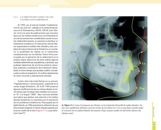 14_Análisis-Cefalométrico-de-Steiner.pdf