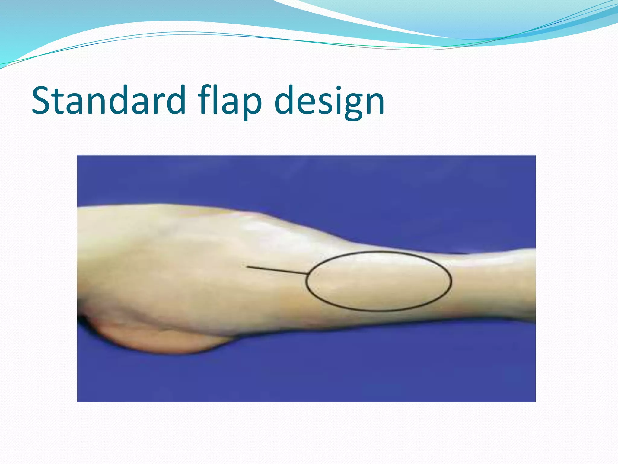 anterolateral thigh flap | PPTX