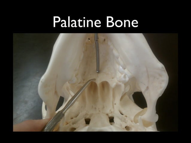 14 bones of the face | KEY