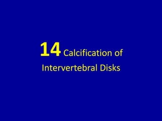 14 calcification of intervertebral disks | PPT