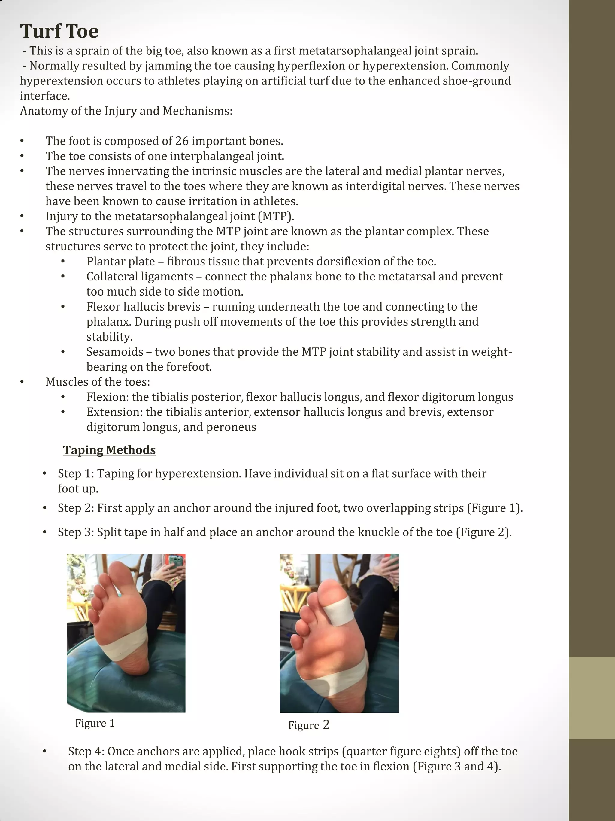 Taping Project | PDF