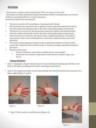 Taping Project | PDF