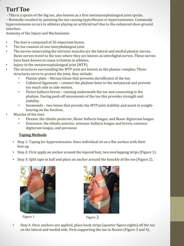 Taping Project | PDF