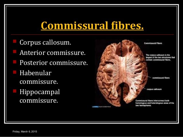 Anterior Commissure