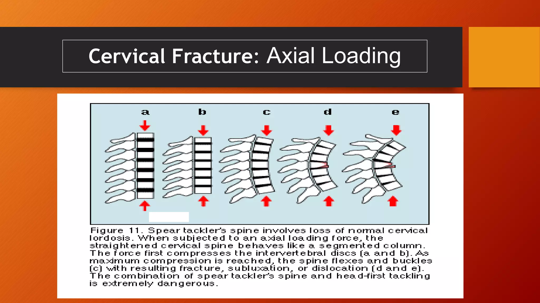 14 CERVICAL SPINE TRAUMA.pptx