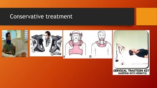 14 CERVICAL SPINE TRAUMA.pptx