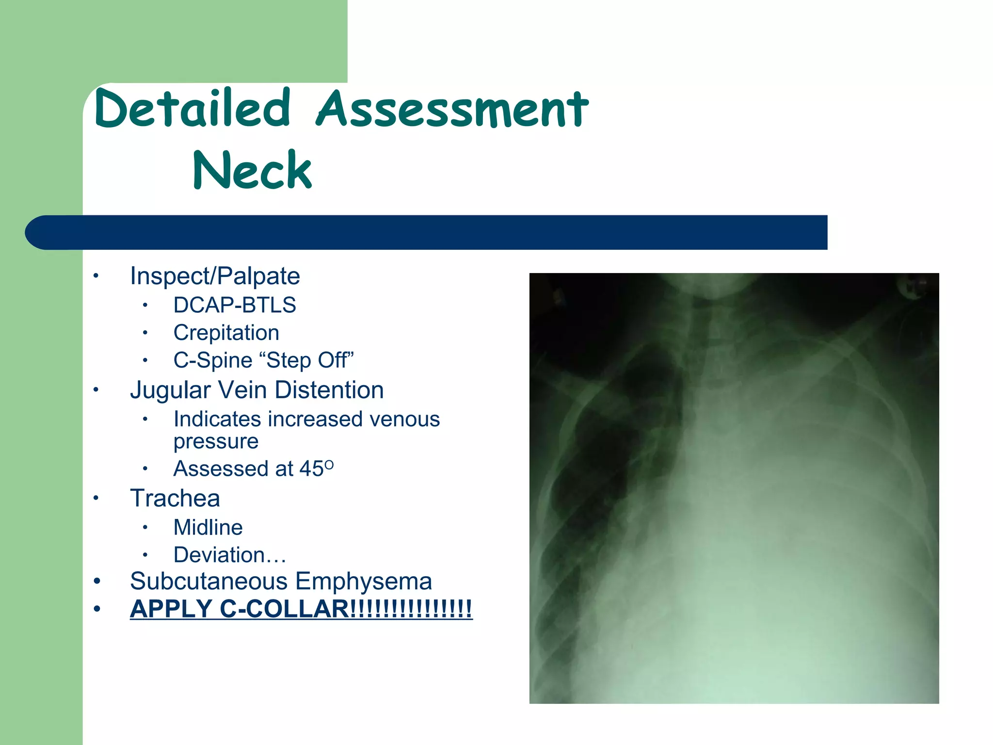 14)Detailed Assessment | PPT