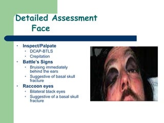14)Detailed Assessment | PPT