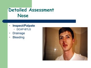 14)Detailed Assessment | PPT