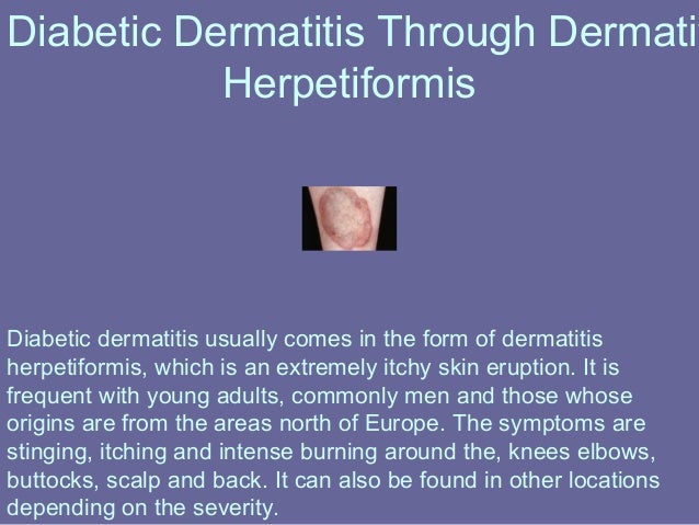 Diabetic Dermatitis