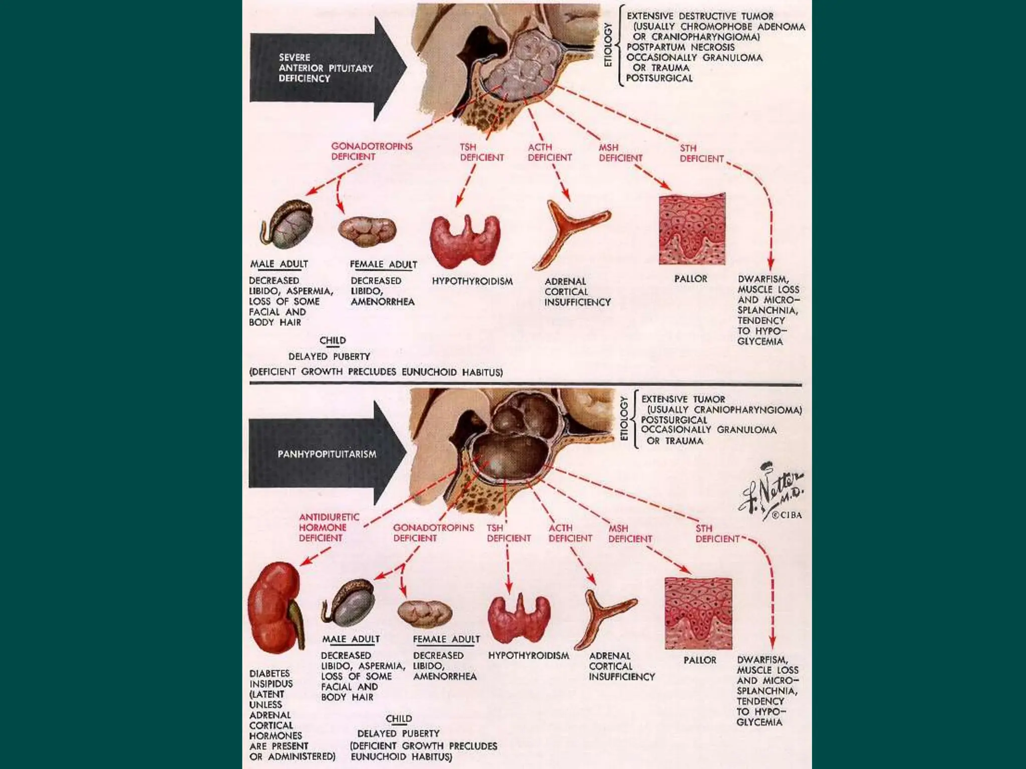 14 Disorders_of_endocrine_system and possible causes.ppt