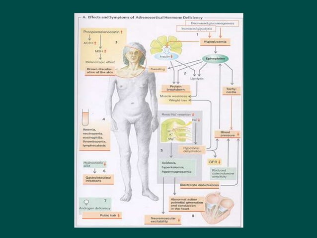 14 Disorders_of_endocrine_system and possible causes.ppt