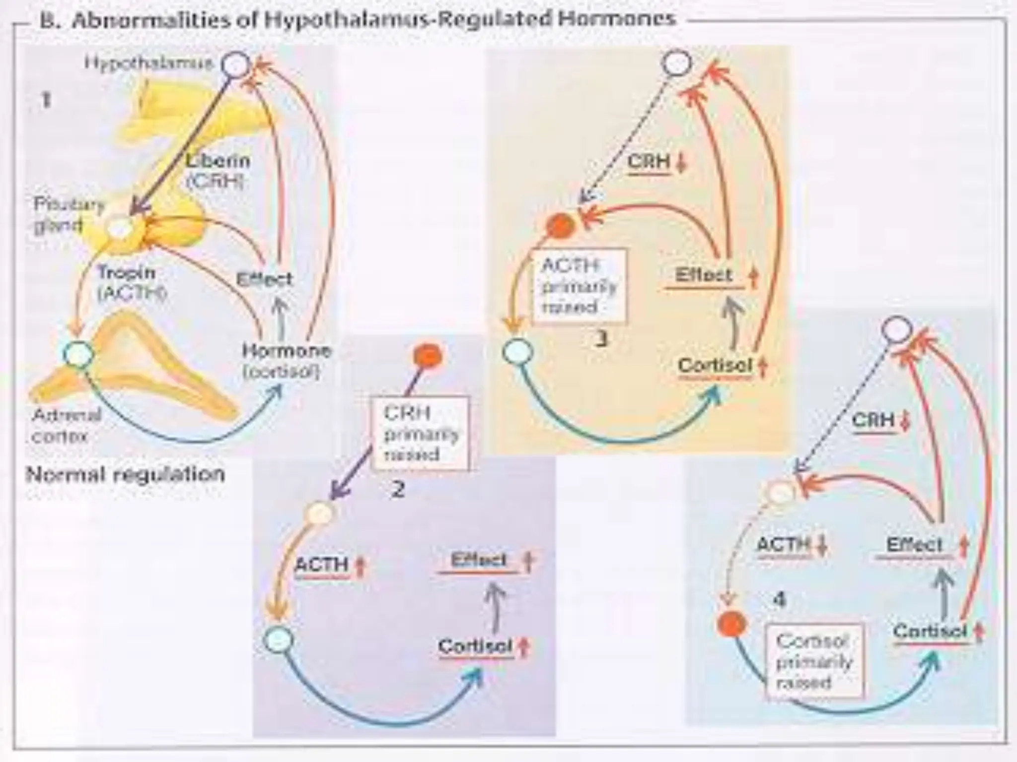 14Disorders_of_endocrine_system signs and symptoms .ppt
