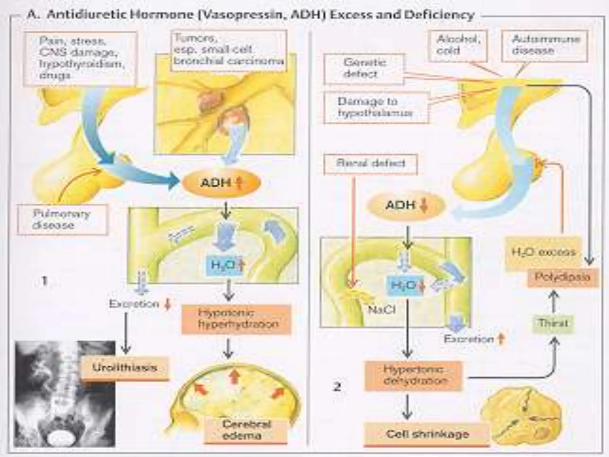 14Disorders_of_endocrine_system signs and symptoms .ppt