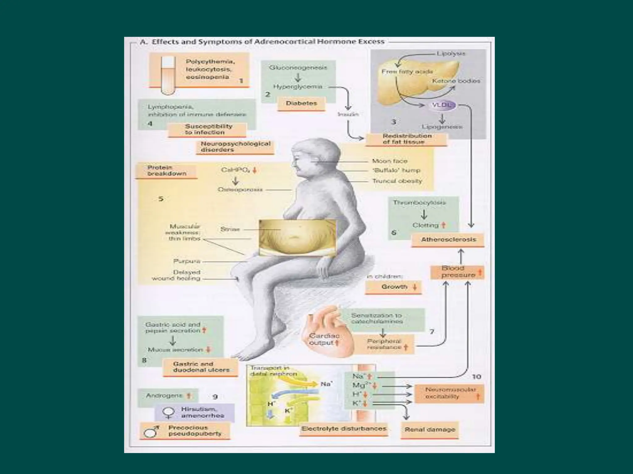 14Disorders_of_endocrine_system signs and symptoms .ppt