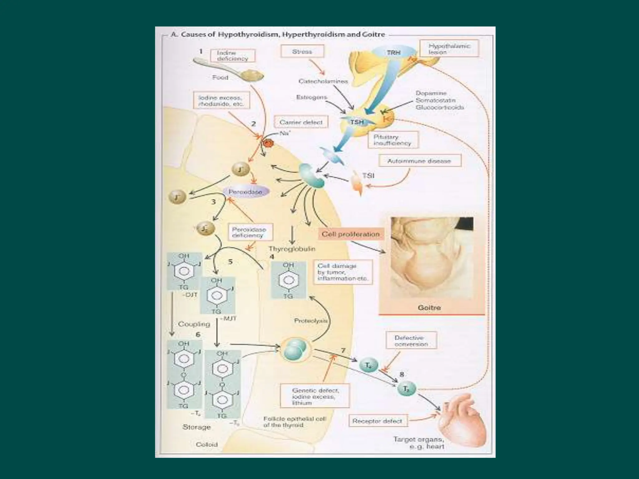 14Disorders_of_endocrine_system signs and symptoms .ppt