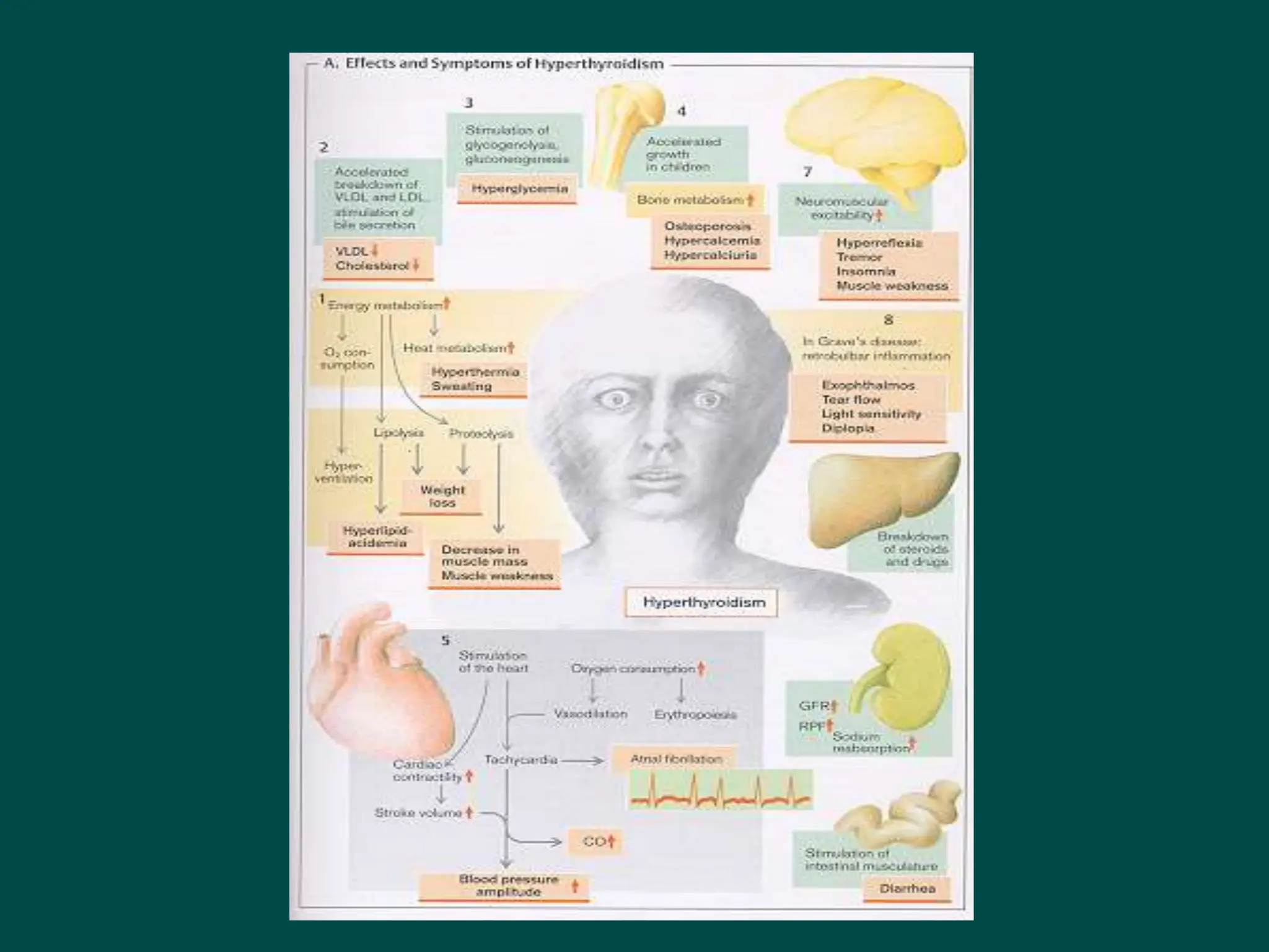 14Disorders_of_endocrine_system signs and symptoms .ppt