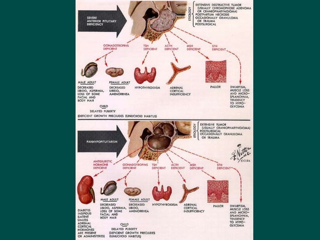 14Disorders_of_endocrine_system signs and symptoms .ppt | Endocrine and ...