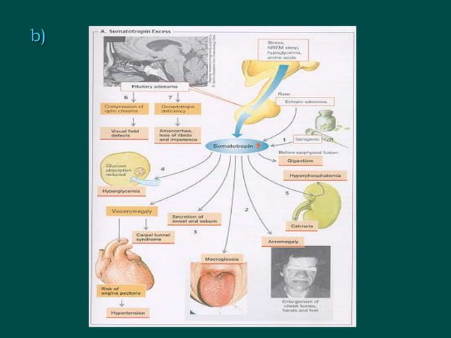 14Disorders_of_endocrine_system signs and symptoms .ppt | Endocrine and ...