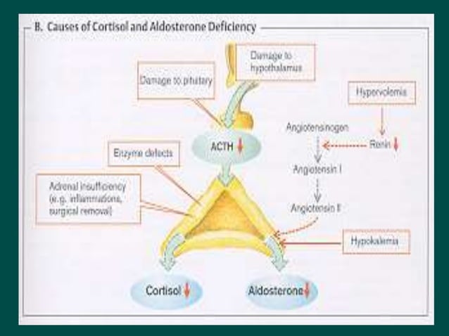 14Disorders_of_endocrine_system signs and symptoms .ppt | Endocrine and ...