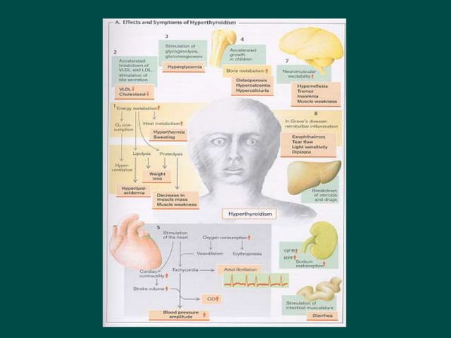 14disordersofendocrinesystem Signs And Symptoms Ppt