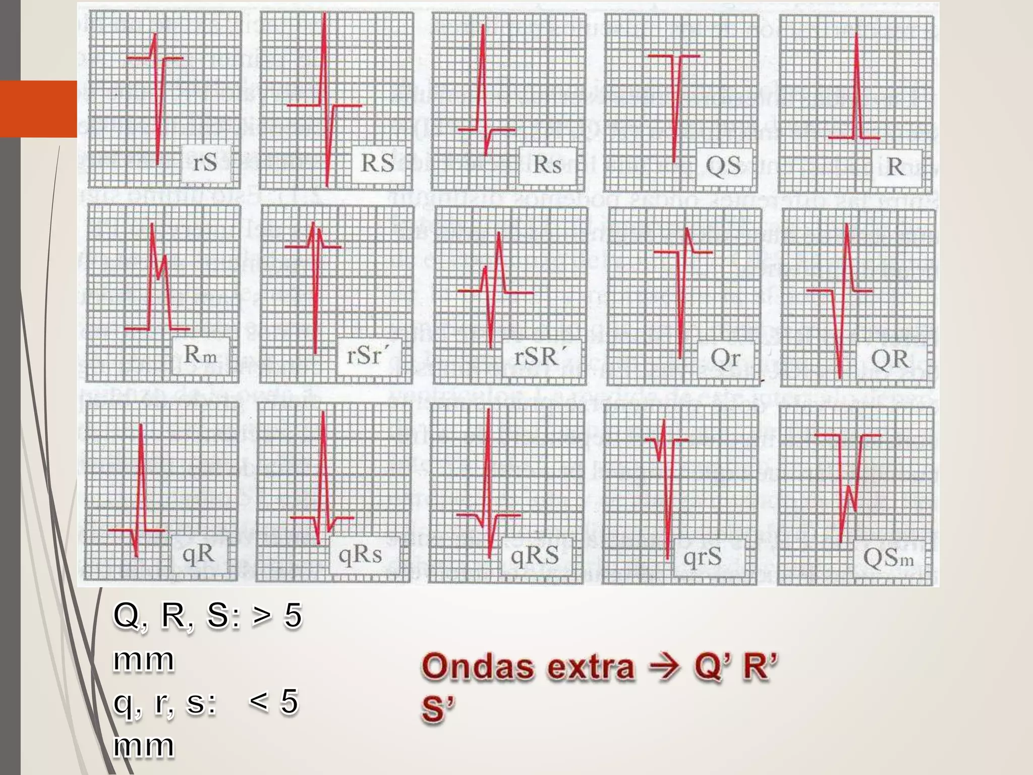 Electrocardiograma ekg | PPT