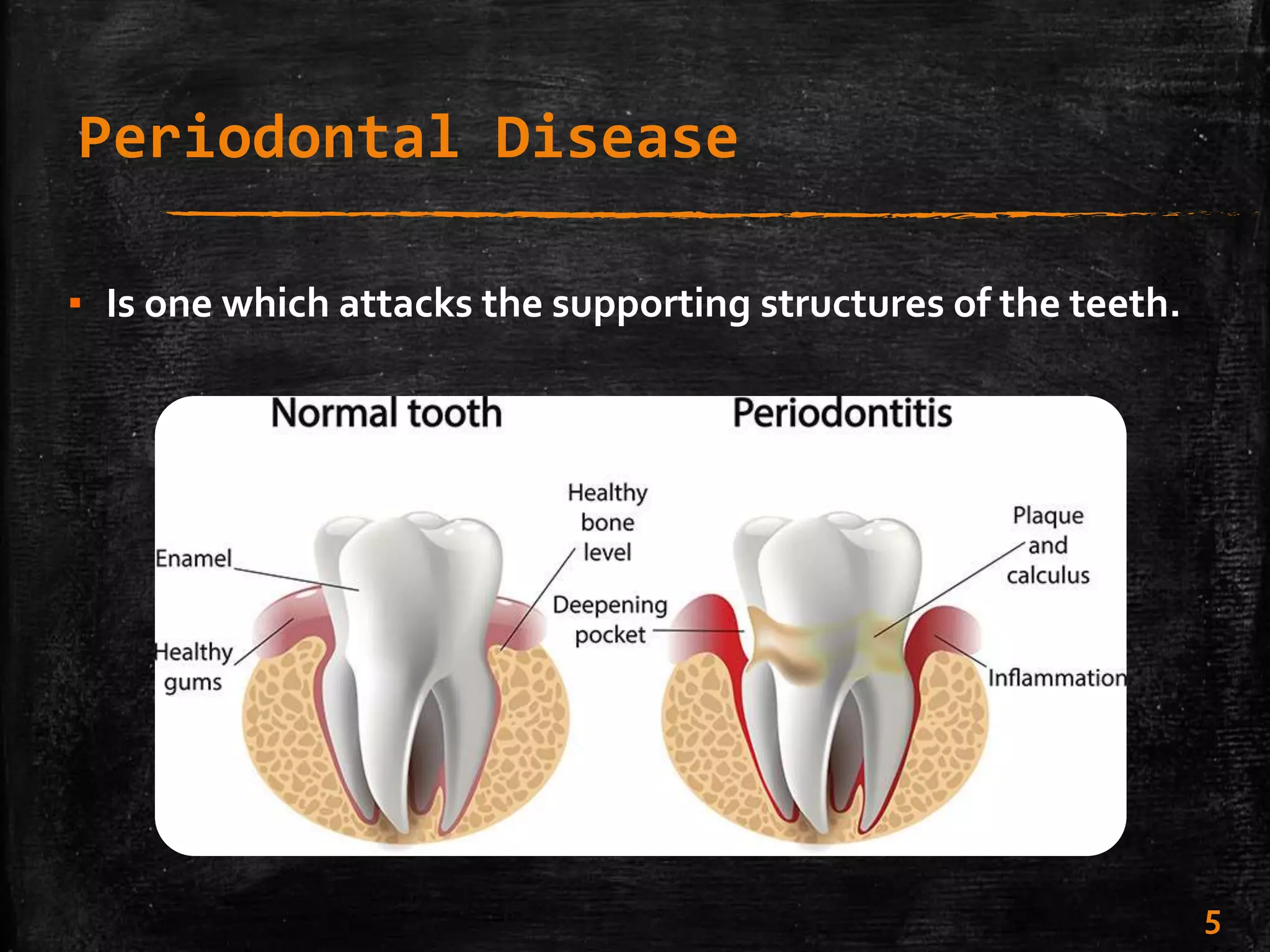 Epidemiology of periodontal disease | PPTX