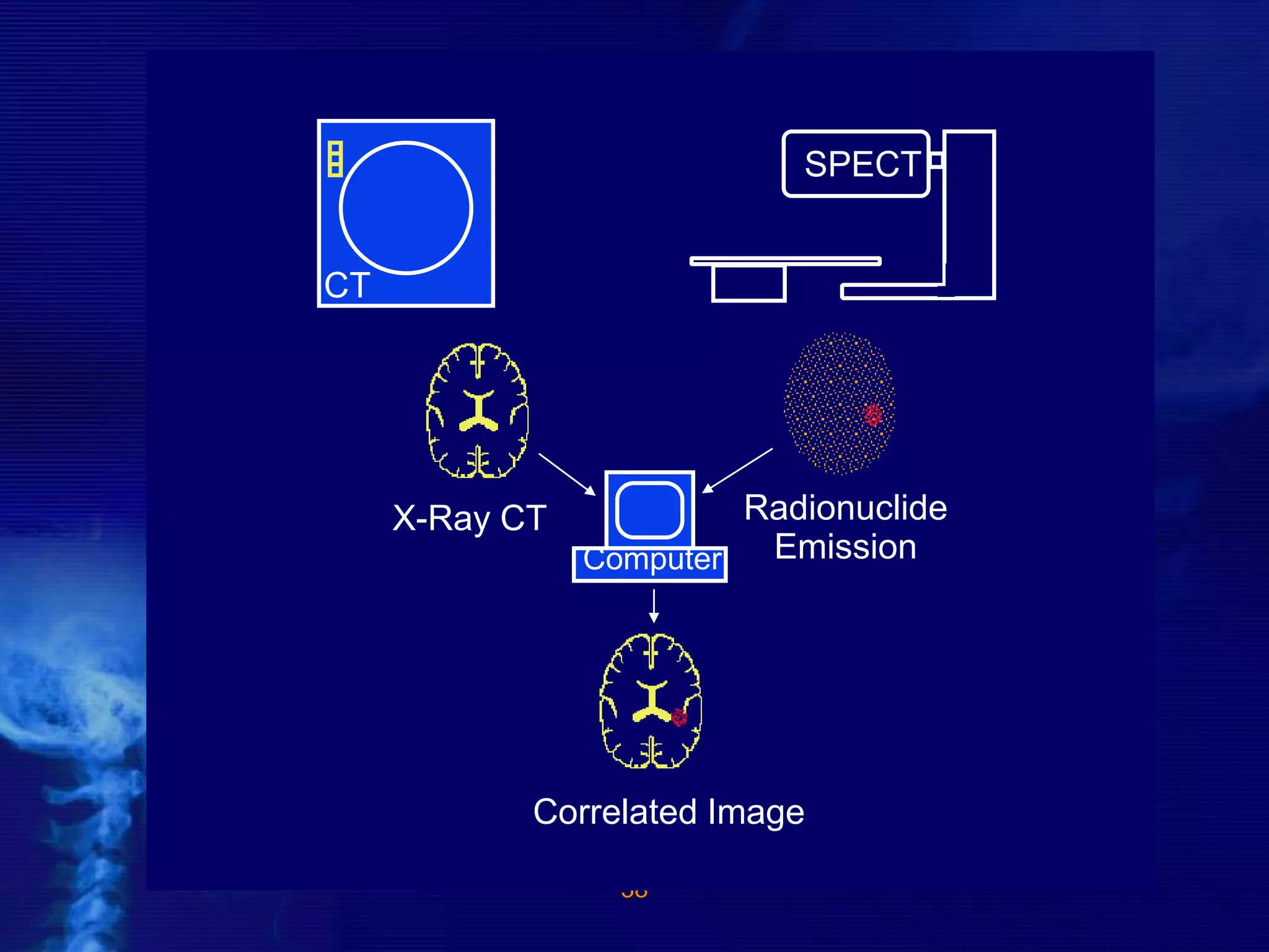 FUSION IMAGING | PPTX