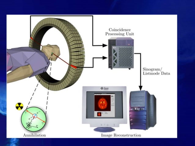 FUSION IMAGING | PPTX