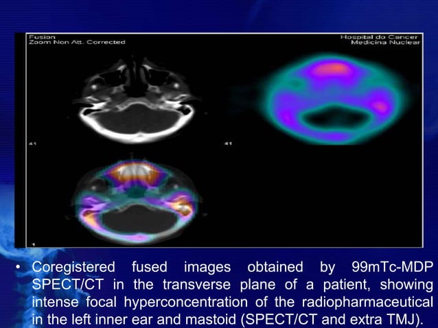 FUSION IMAGING | PPTX