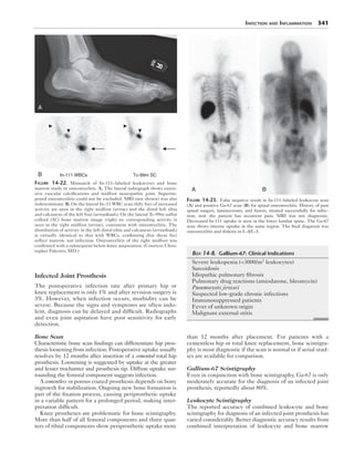 14 infection inflammation | PDF