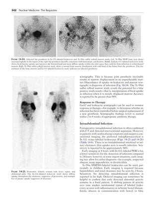 14 infection inflammation | PDF