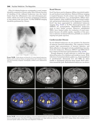14 infection inflammation | PDF