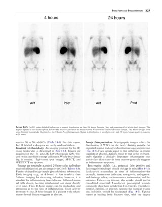 14 infection inflammation | PDF