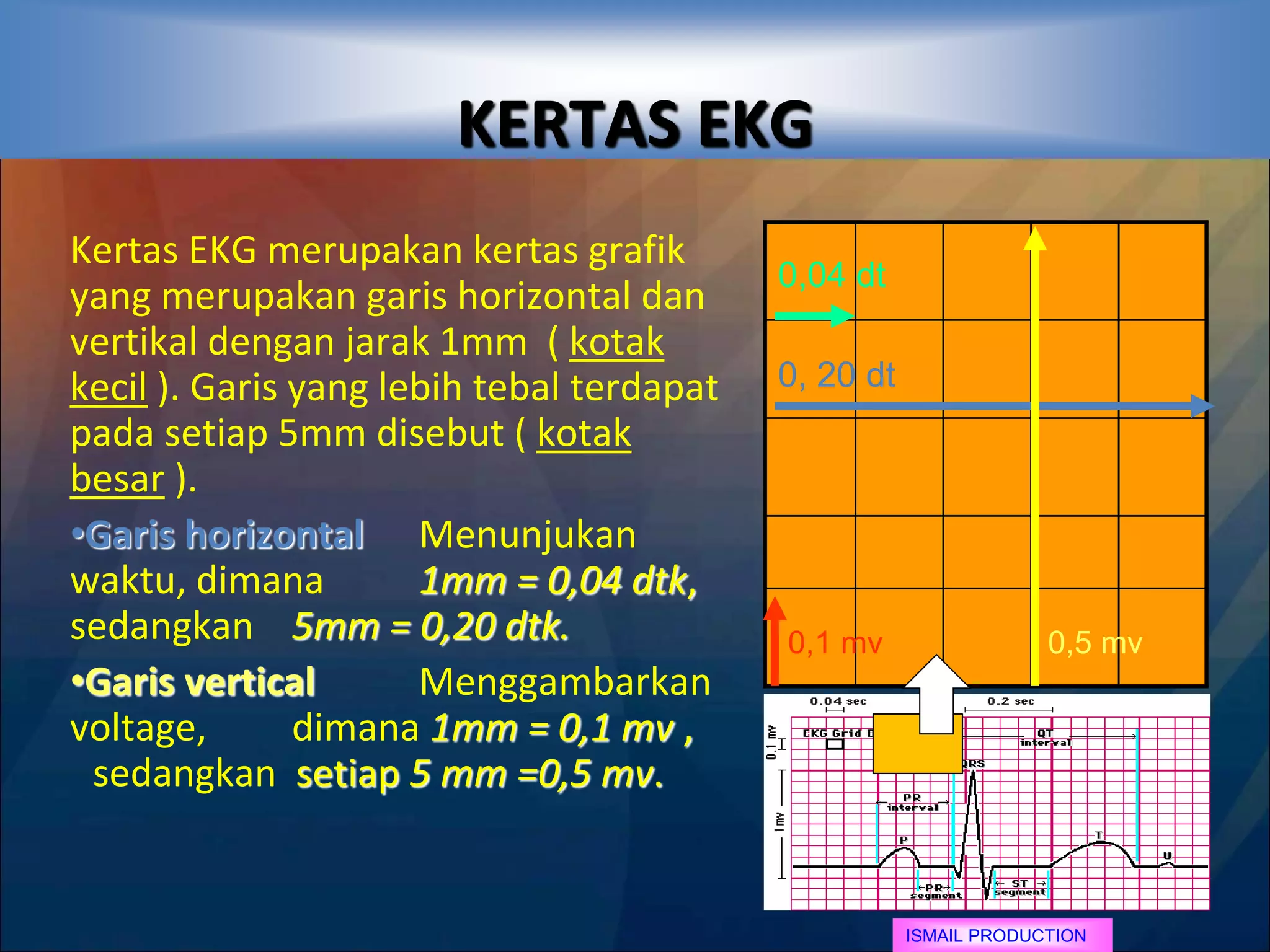 14 Konsep Dasar EKG | PDF