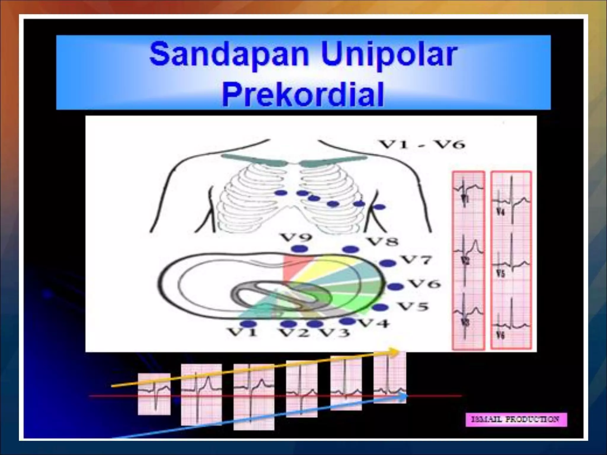 14 Konsep Dasar EKG | PDF