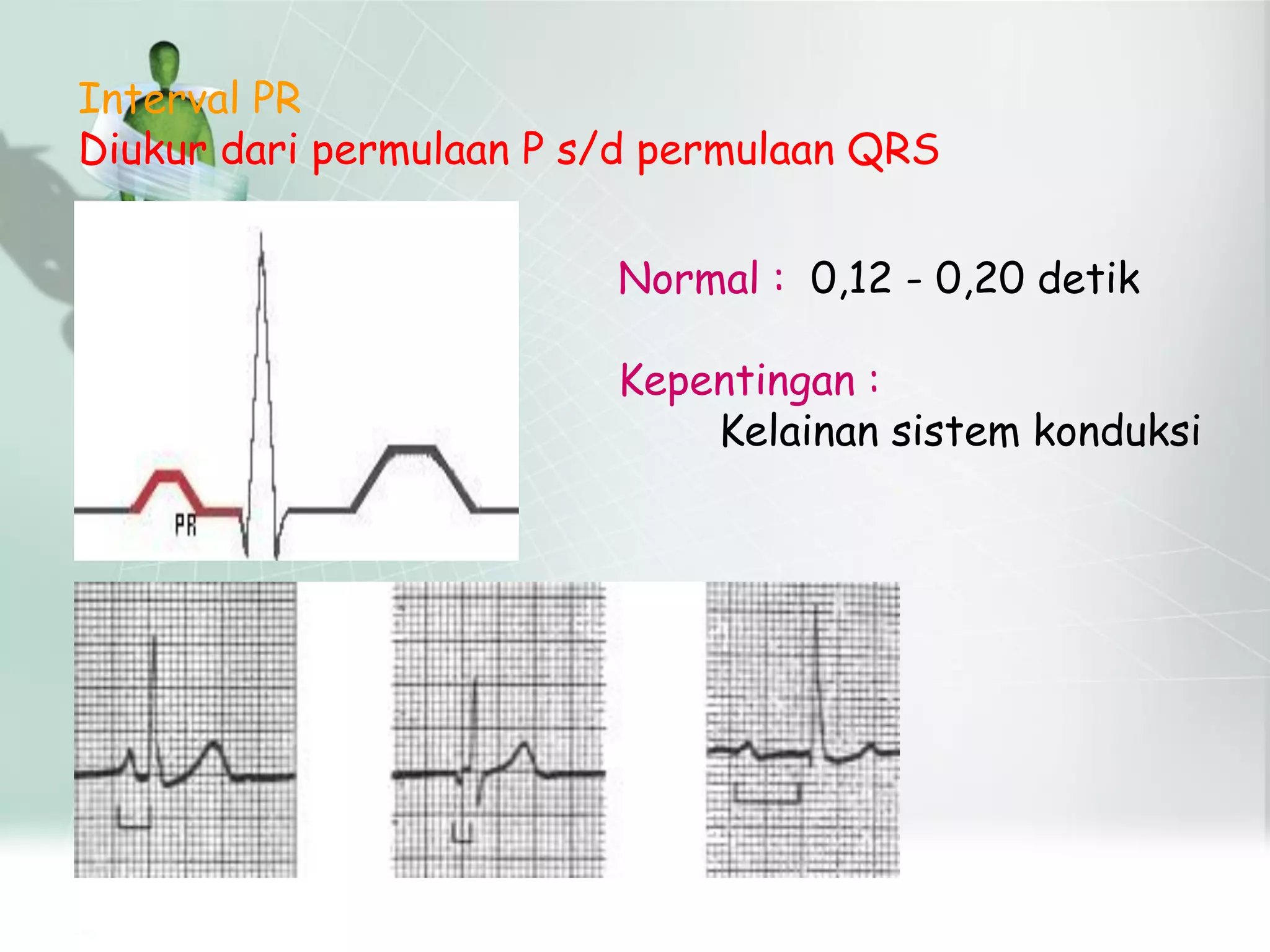 14 Konsep Dasar EKG | PDF