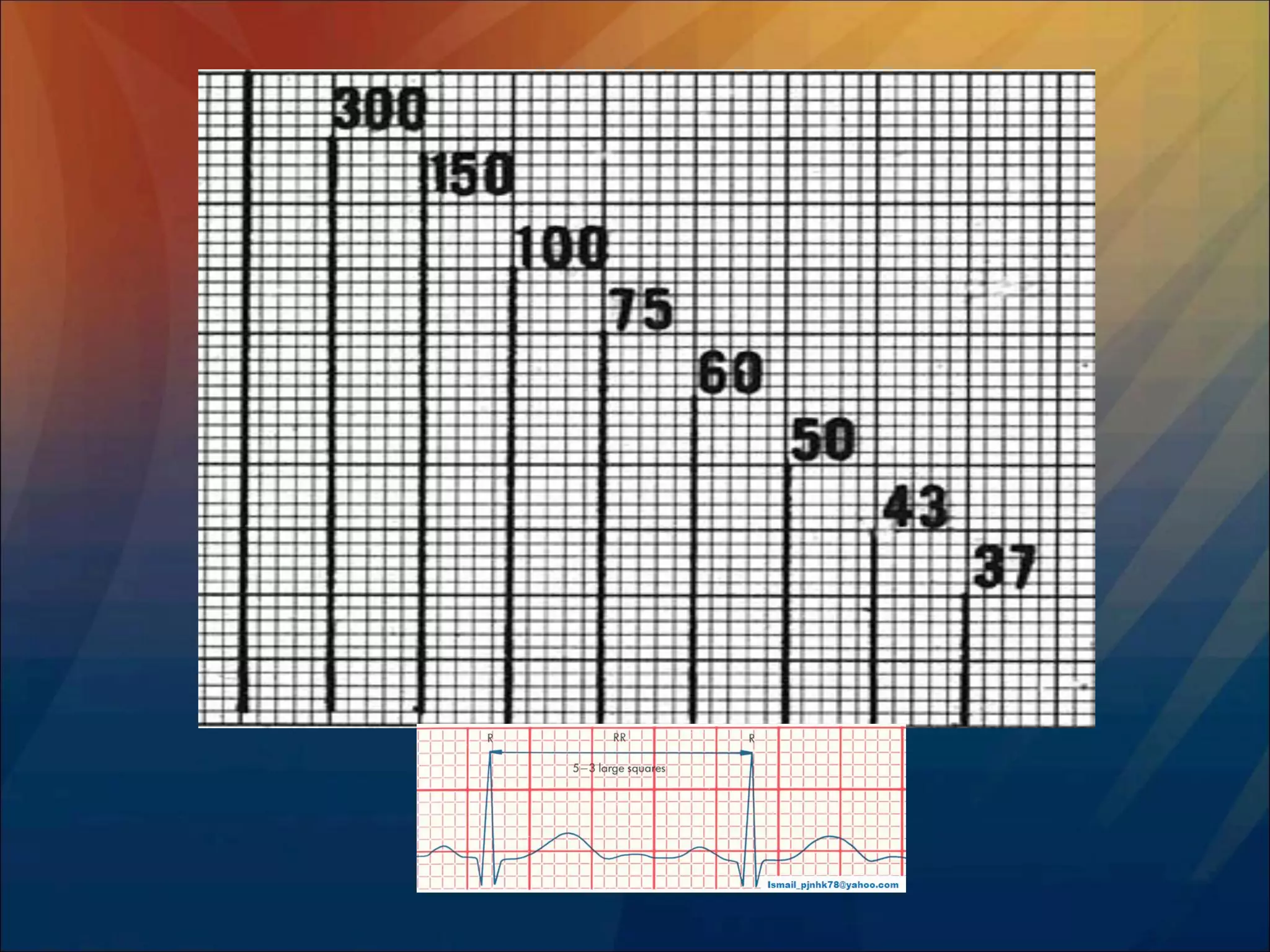 14 Konsep Dasar EKG | PDF