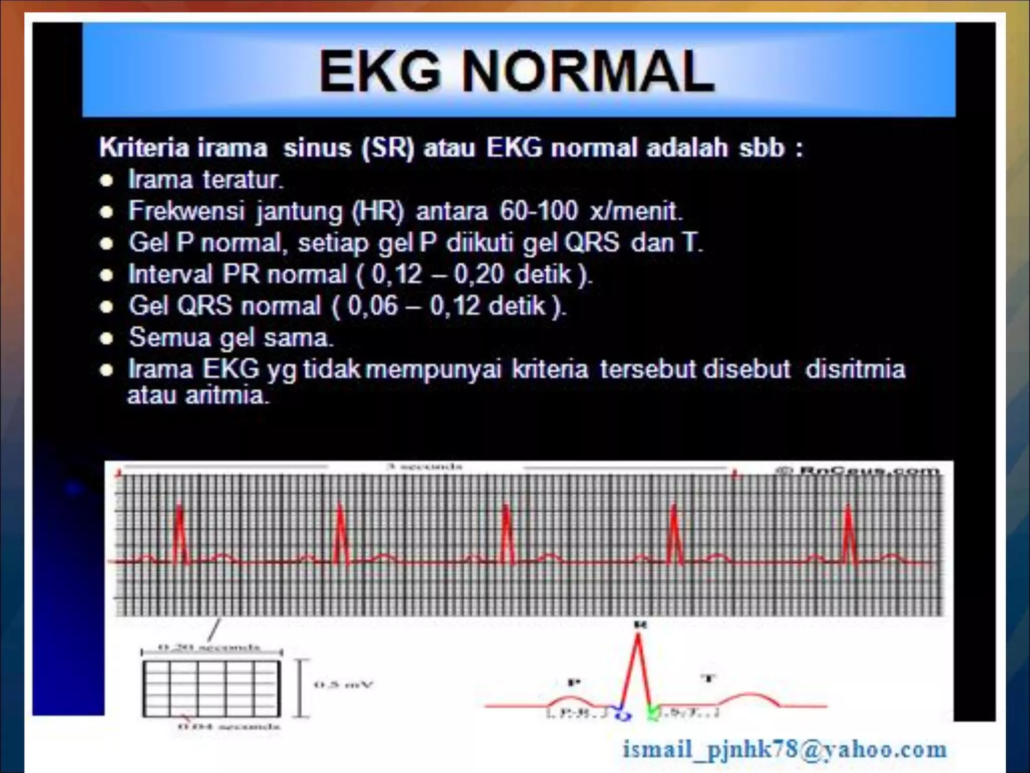 14 Konsep Dasar EKG | PDF