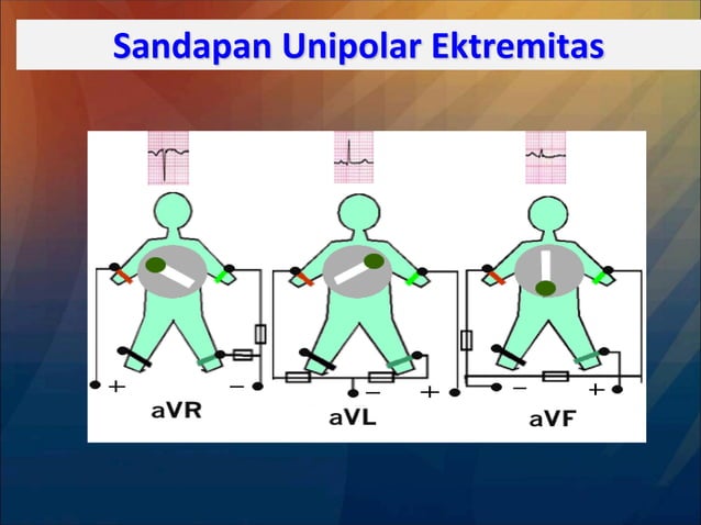 14 Konsep Dasar EKG | PDF