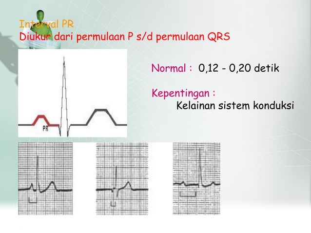 14 Konsep Dasar EKG | PDF