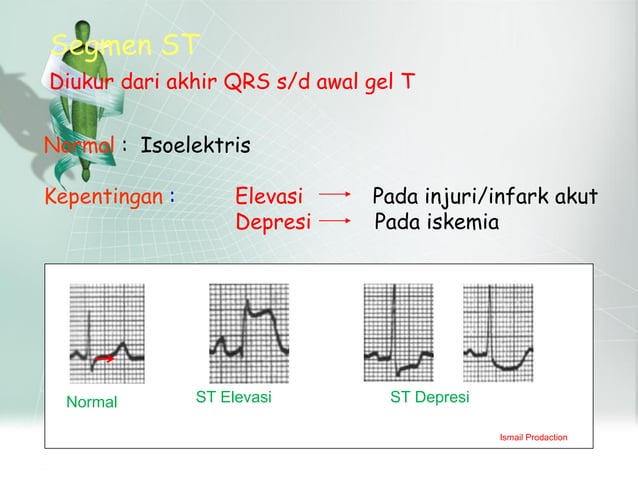 14 Konsep Dasar EKG | PDF