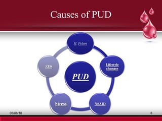 peptic ulcer & their new molecular target | PPT | Digestive Disorders ...