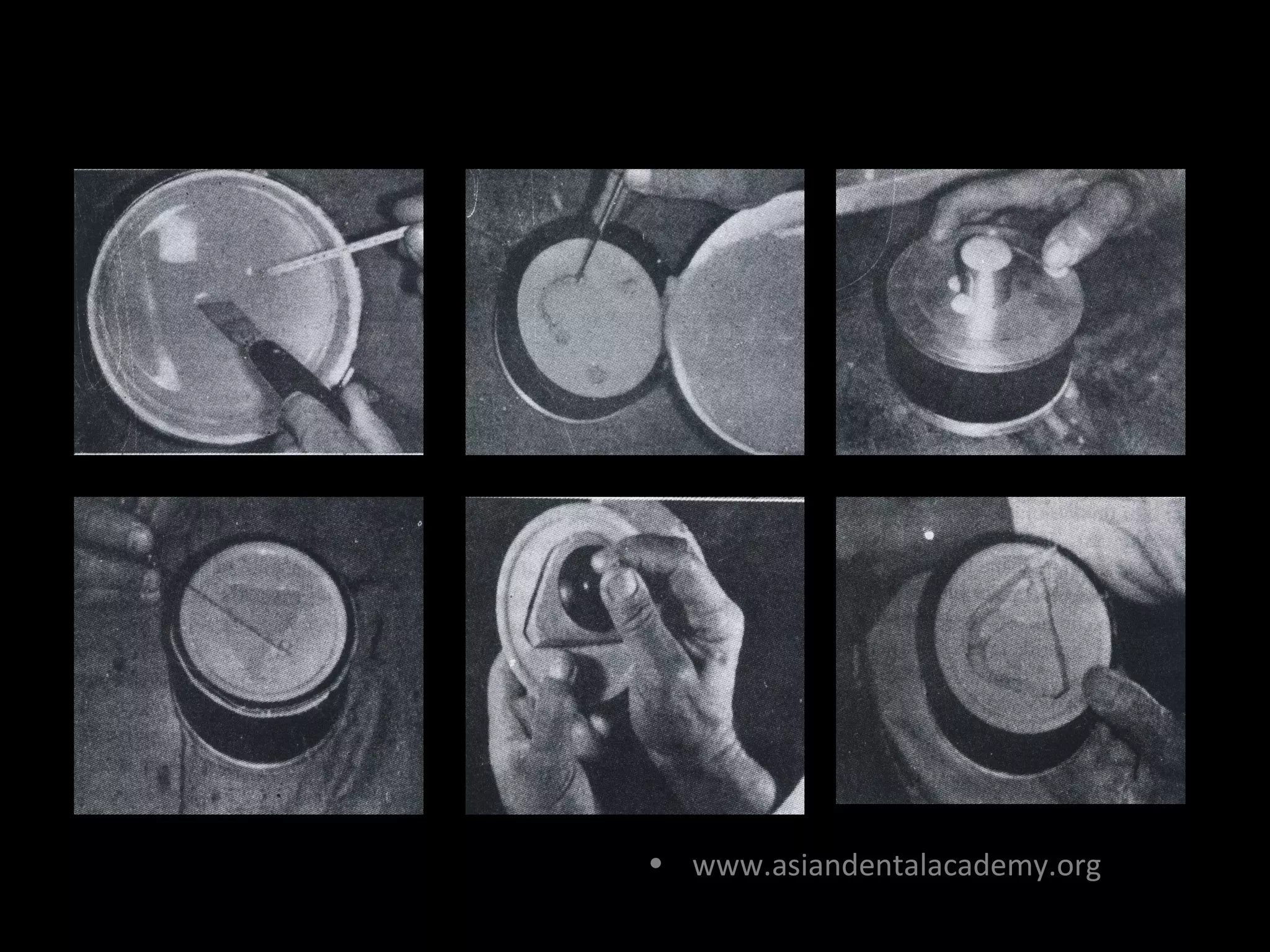 lab procedures in removable partial dentures | PPT