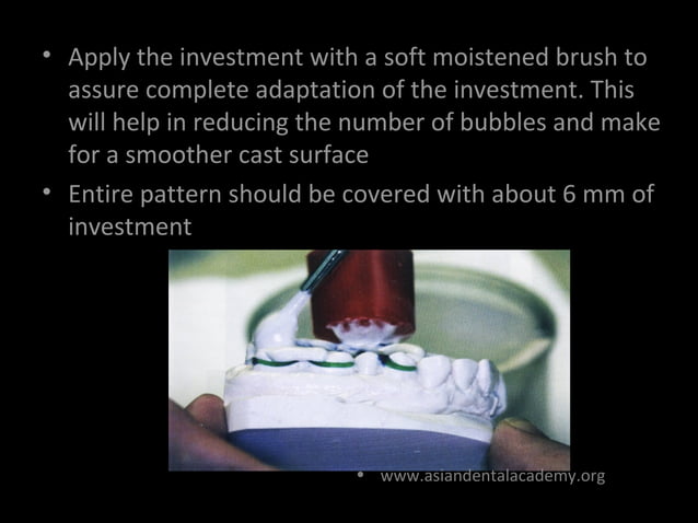 lab procedures in removable partial dentures | PPT