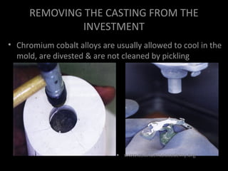 lab procedures in removable partial dentures | PPT