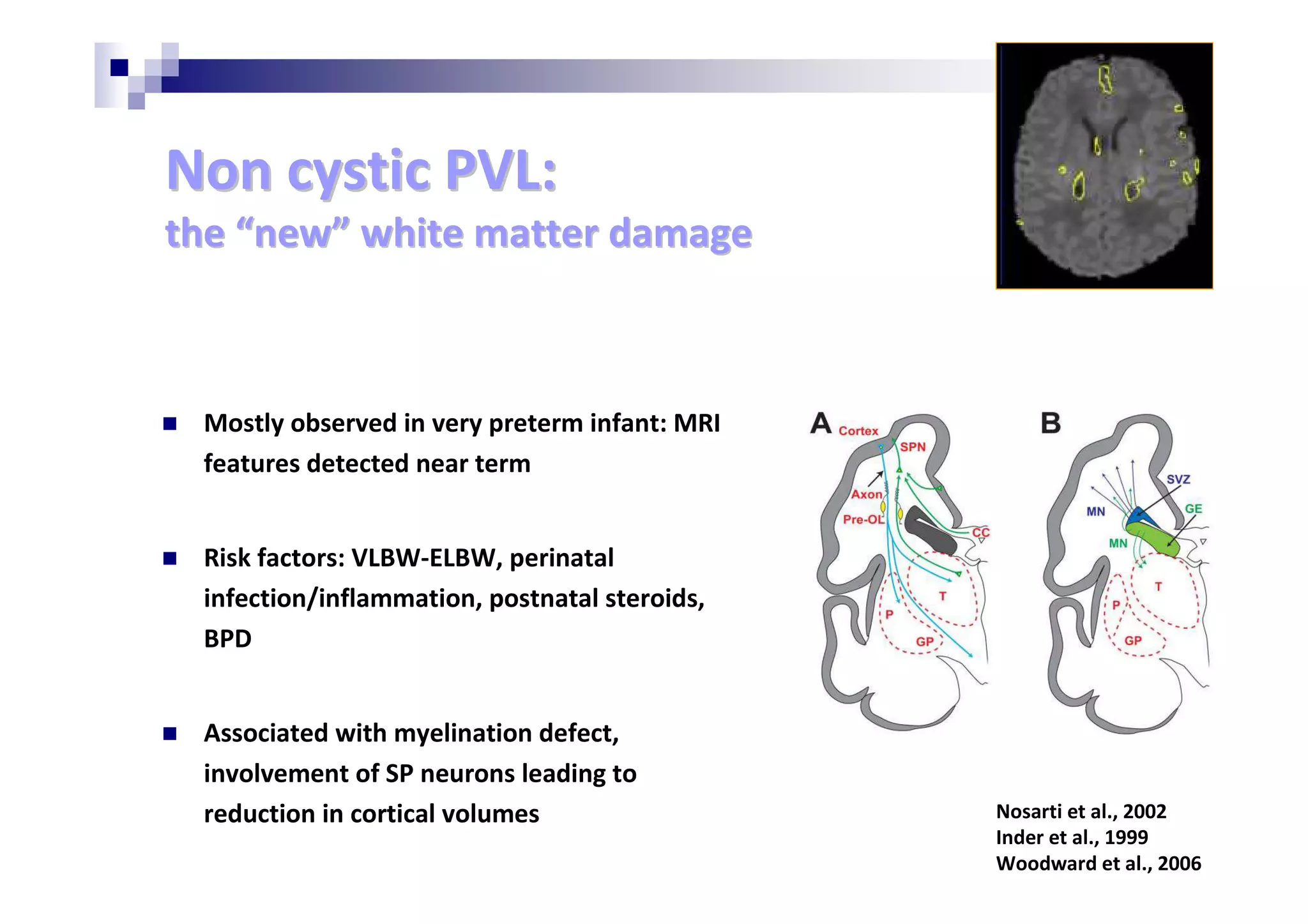 Neuroprotection in preterm infants: hope or utopy? | PDF
