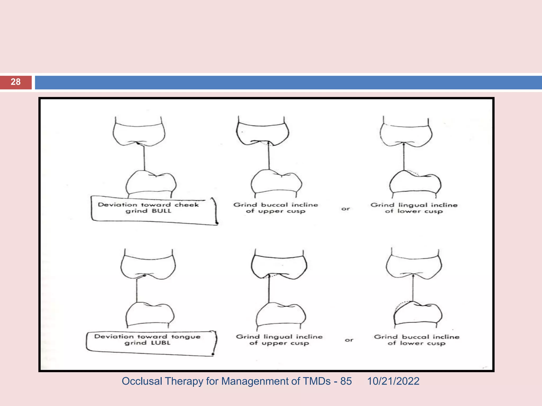 14 Occlusal therapy for management of TMDs.pptx