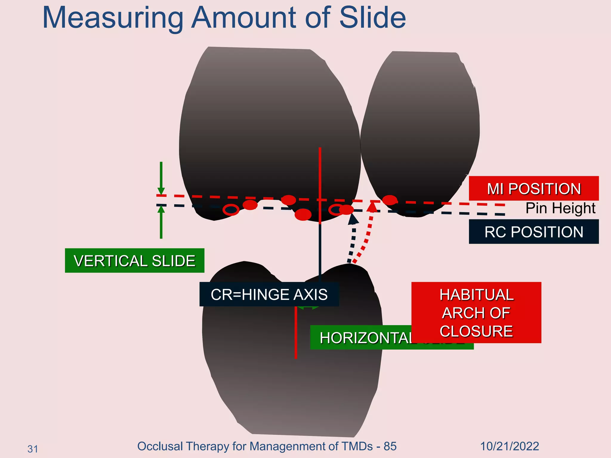 14 Occlusal therapy for management of TMDs.pptx