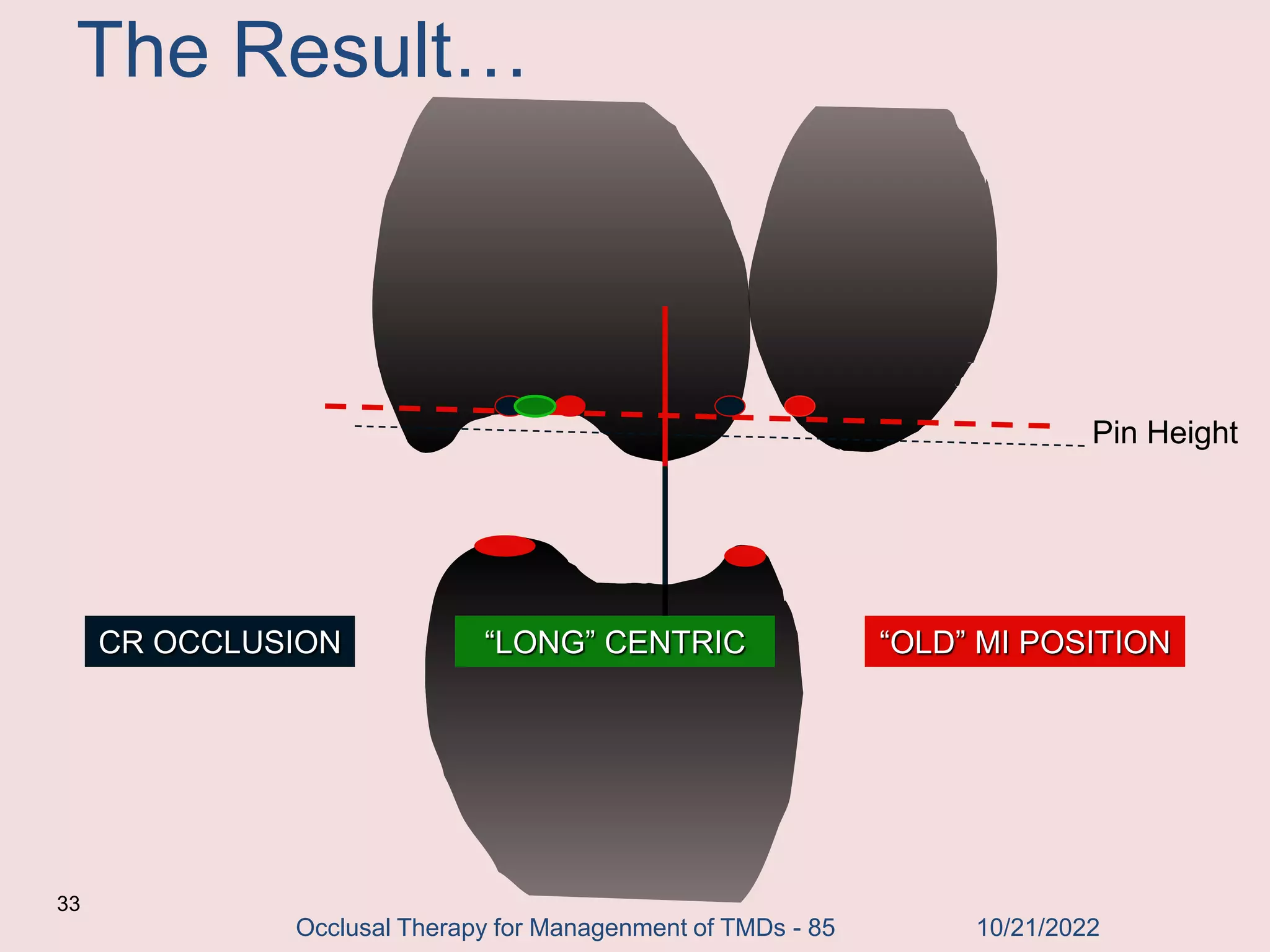 14 Occlusal therapy for management of TMDs.pptx